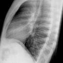 Thoraxbereich MTR | OrthoRad